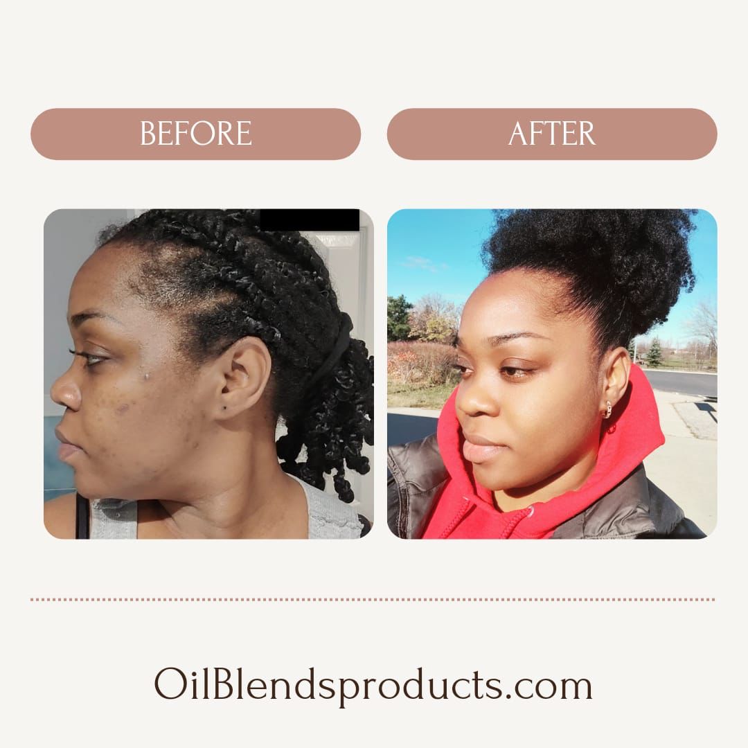 The results are amazing – OilBlends - Traditional Plant Based Beauty ...